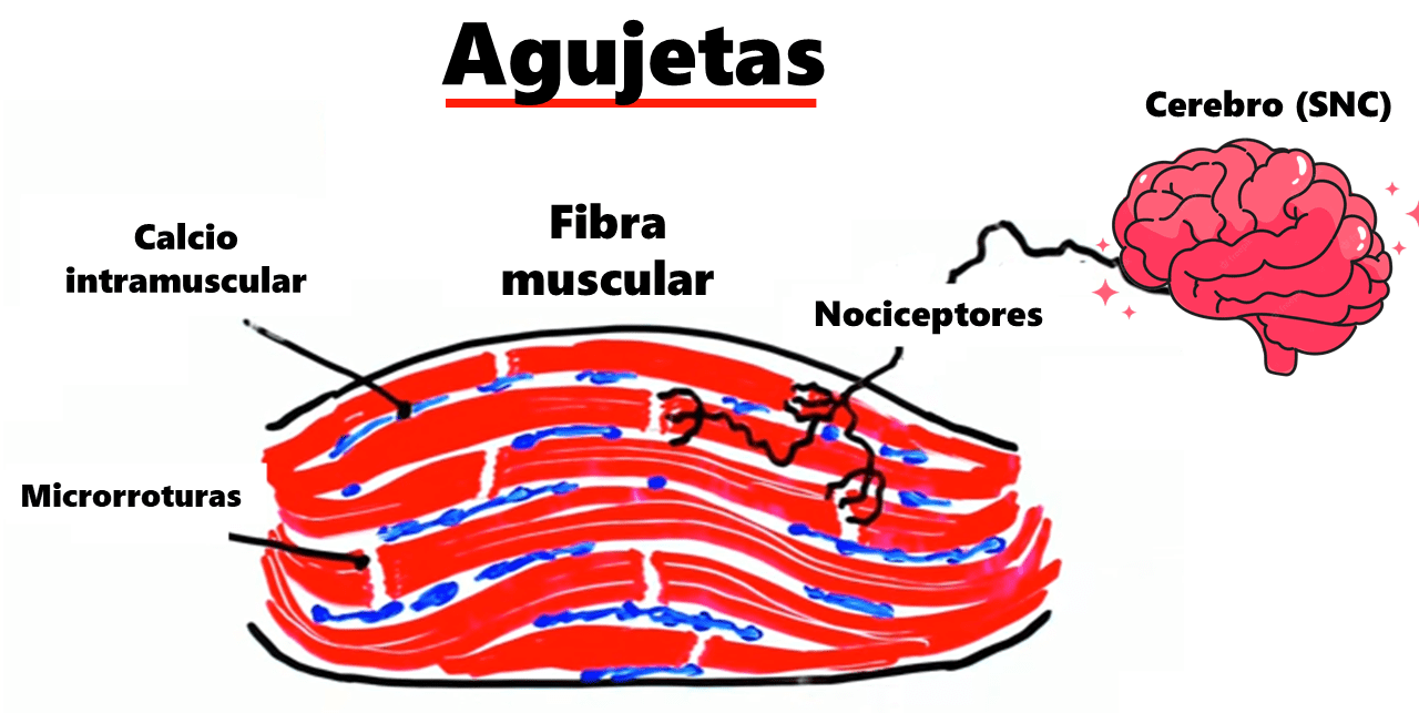 ¿Qué ejercicios generan más agujetas? - PowerExplosive